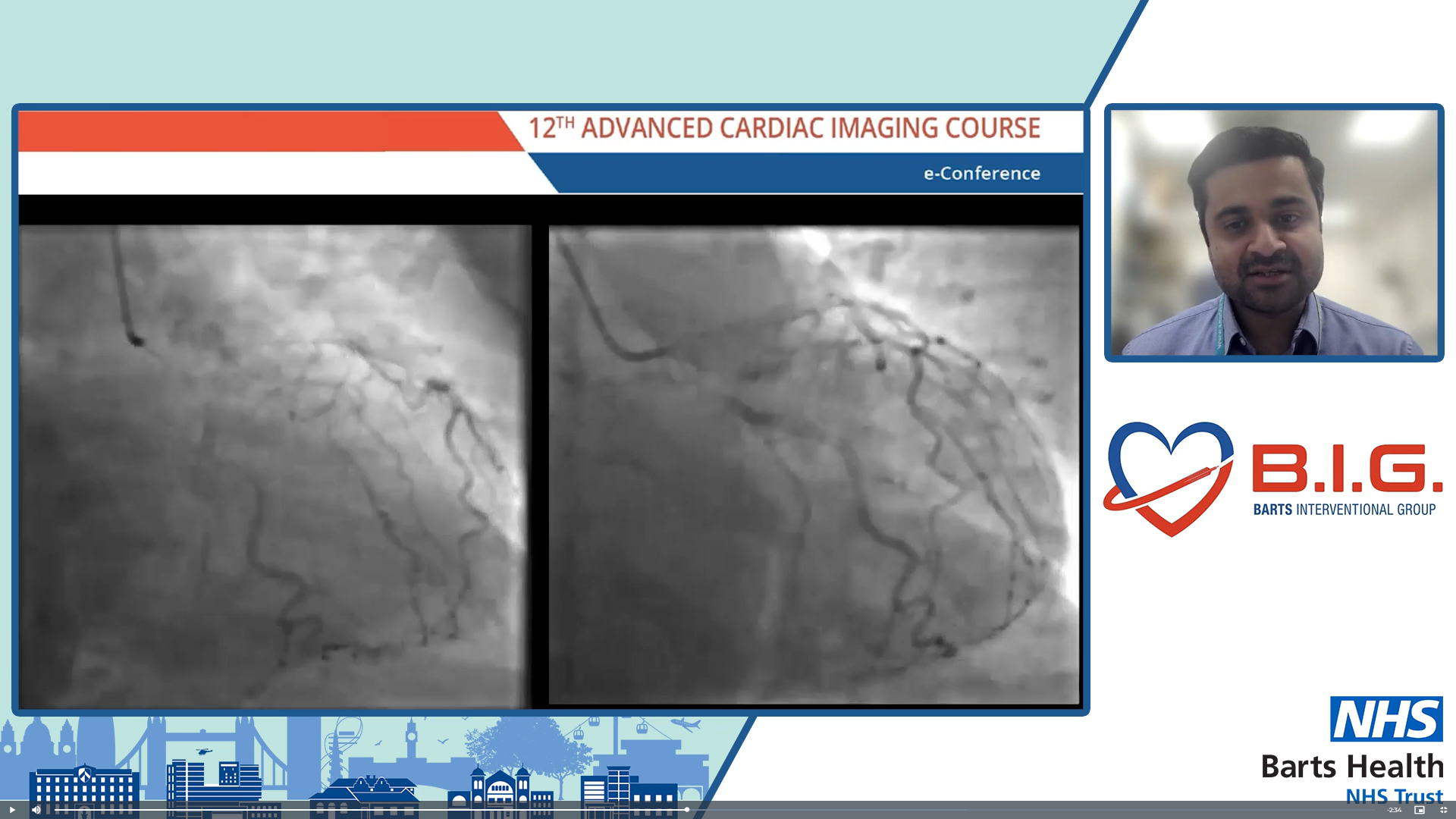 Case Study: 12th Advanced Cardiac Imaging Course - Millbrook Medical ...
