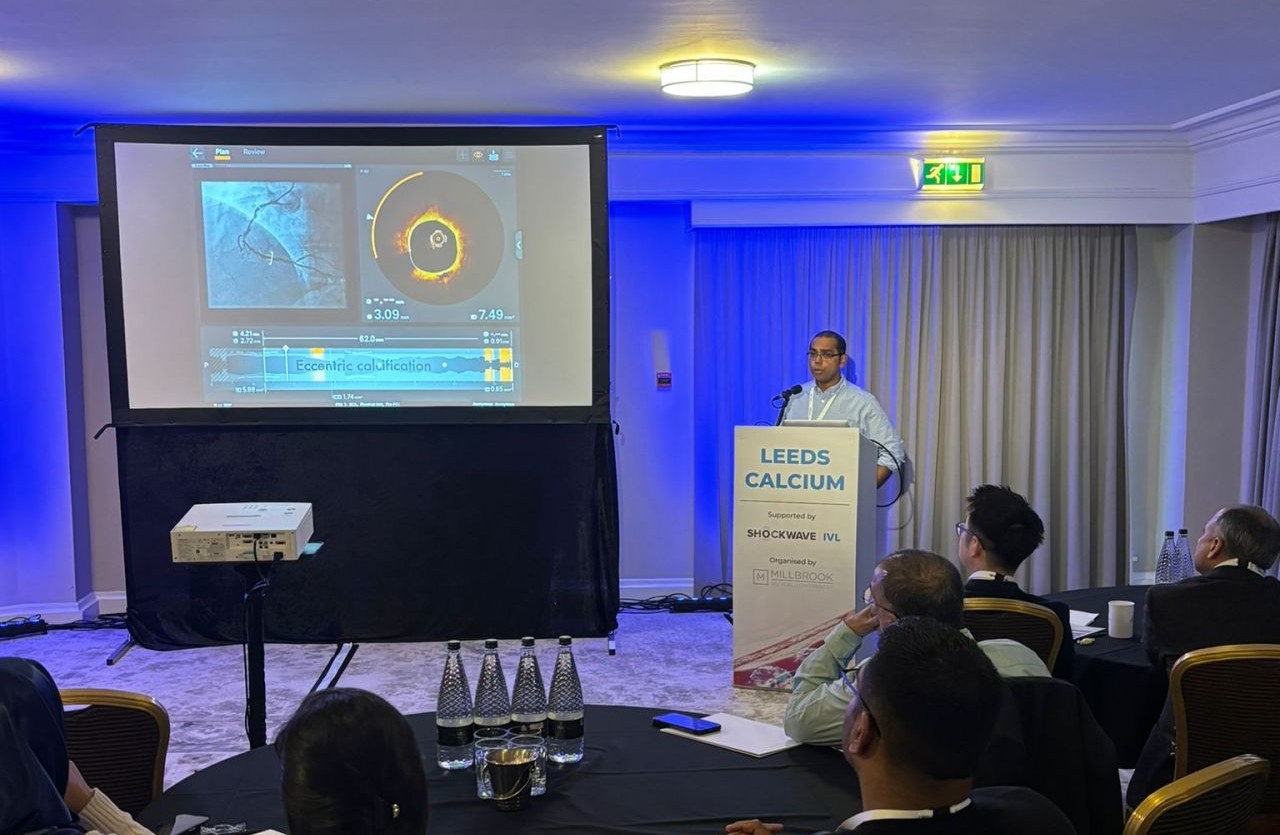 Case Study: Leeds Calcium 2025 | Millbrook